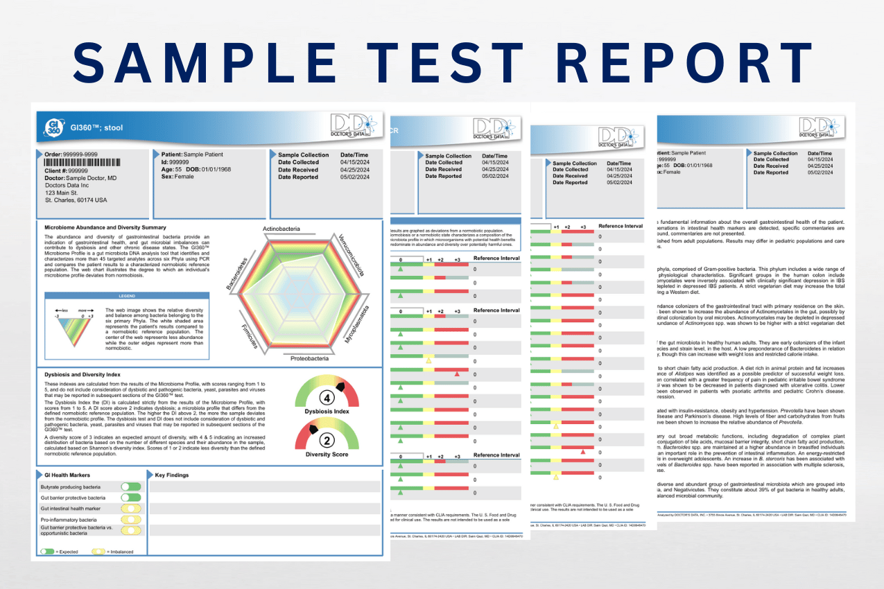GI360™ Microbiome Stool Test Kit - Advanced Gut Health Analysis | IFDW ...